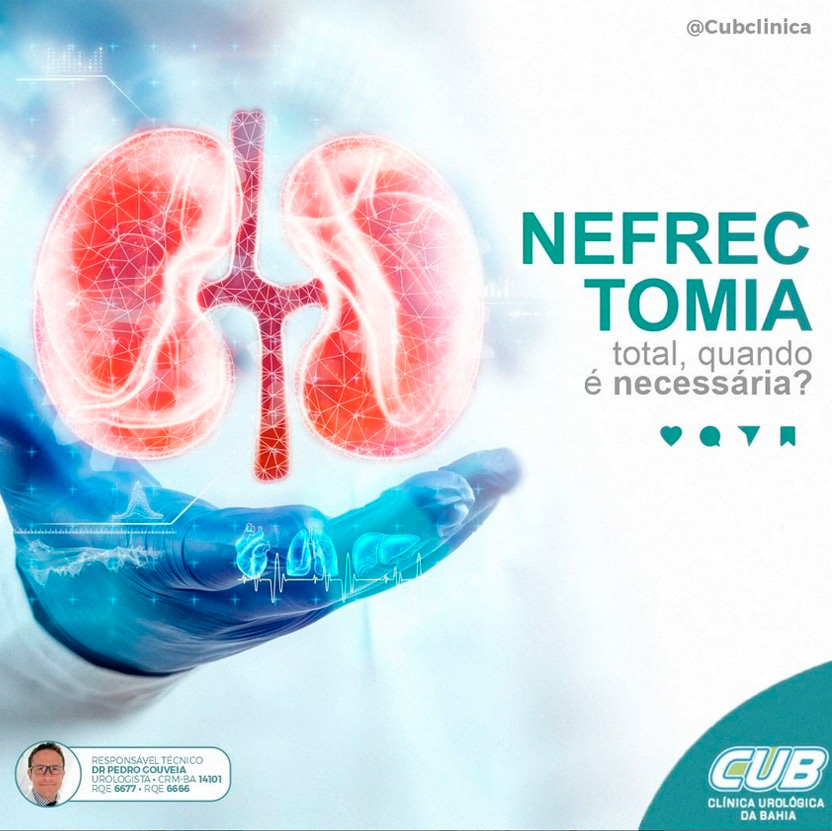Nefrectomia Total - Quando é necessária? - CUB - Clínica Urológica da ...