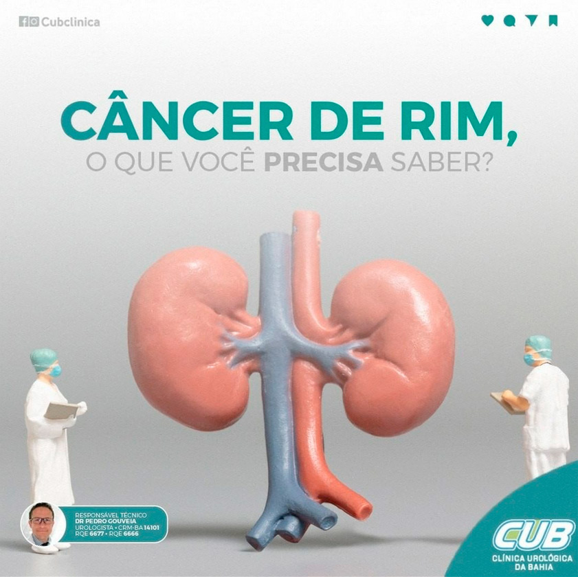 Câncer de rim, o que você precisa saber? - CUB - Clínica Urológica da ...